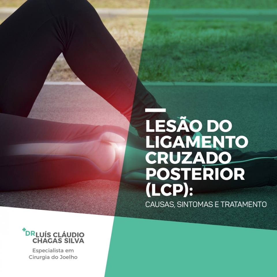 Lesão do Ligamento Cruzado Posterior (LCP) – Causas, Sintomas e ...