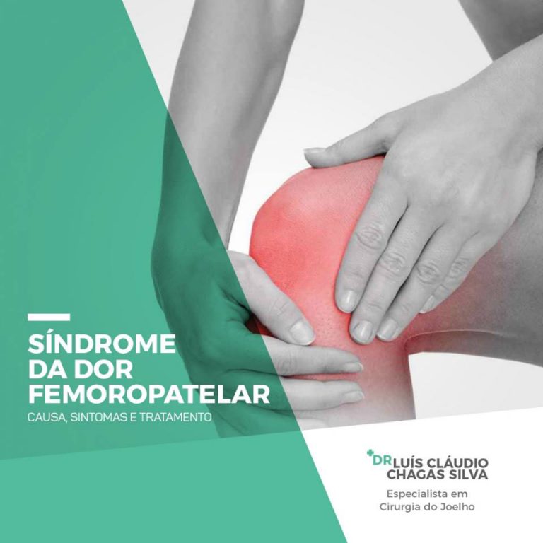 Síndrome da Dor Femoropatelar – Causa, Sintomas e Tratamento – Drº Luis ...