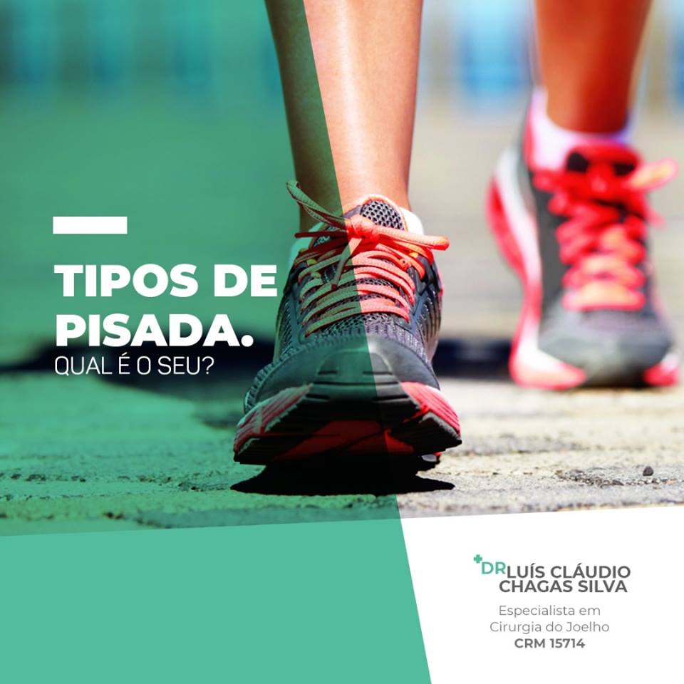 Tipos de Pisada. Qual é o Seu? – Drº Luis CLaudio Chagas – Especialista ...